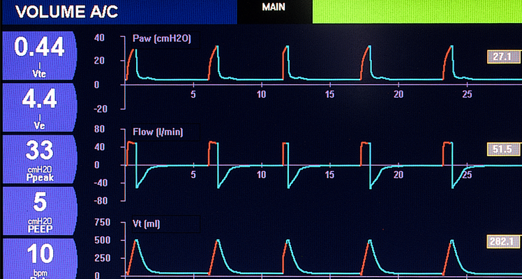 Mechanical ventilation I: Basic concepts – Critical Concepts